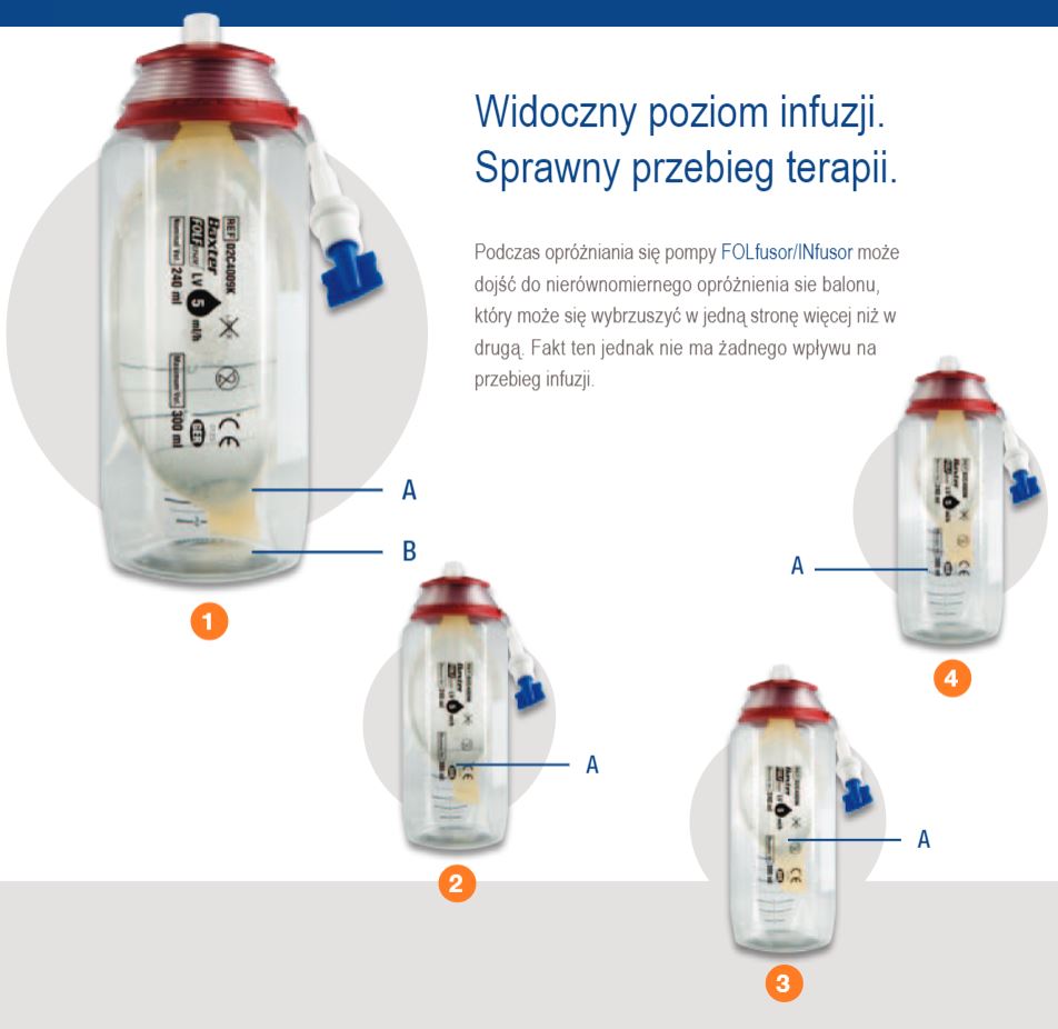 Pompa Elastomerowa Baxter 240ml FOLFUSOR LV 5ml/h - Spacemed